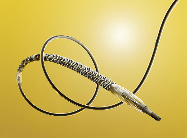 Resolute Onyx, 1er stent liberador fármaco disponible grandes tamaños