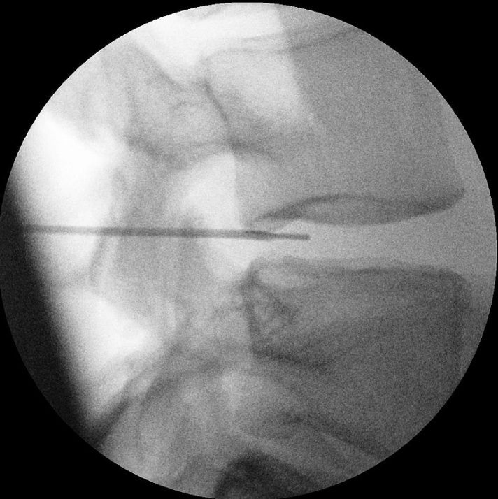 (portada) rx lateral - Farmacosalud