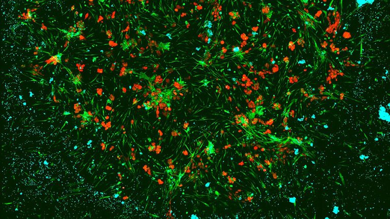 (portada) Microscopía confocal ex vivo inmunocompetente humanizado ...